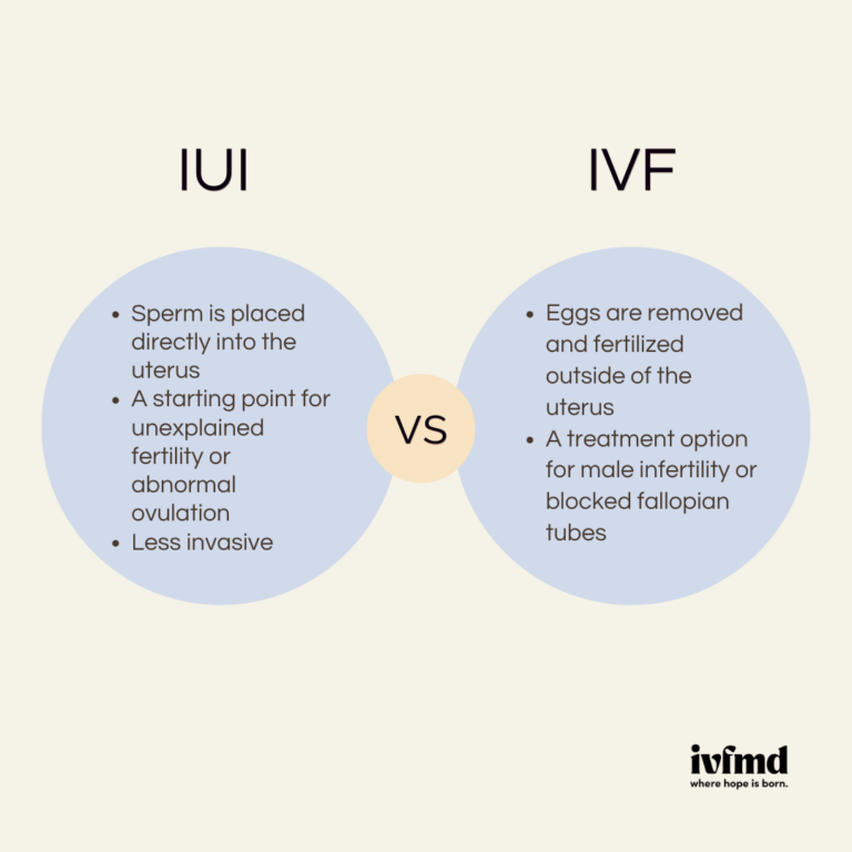 What is IUI? Find Out About Intrauterine Insemination at IVFMD